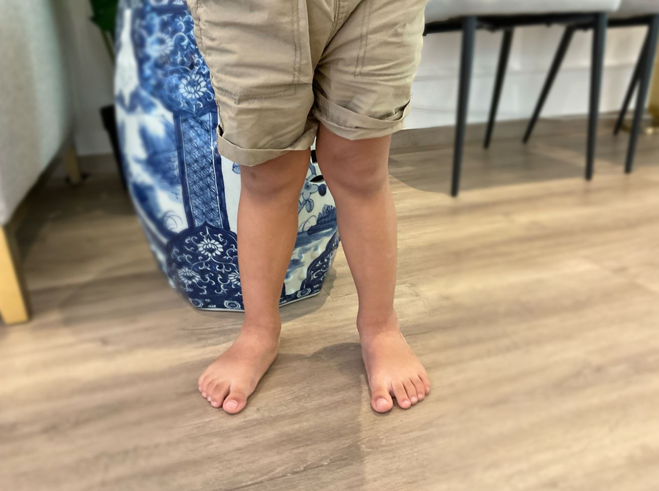 Knock Knees In Children Causes Treatment Straits Podiatry